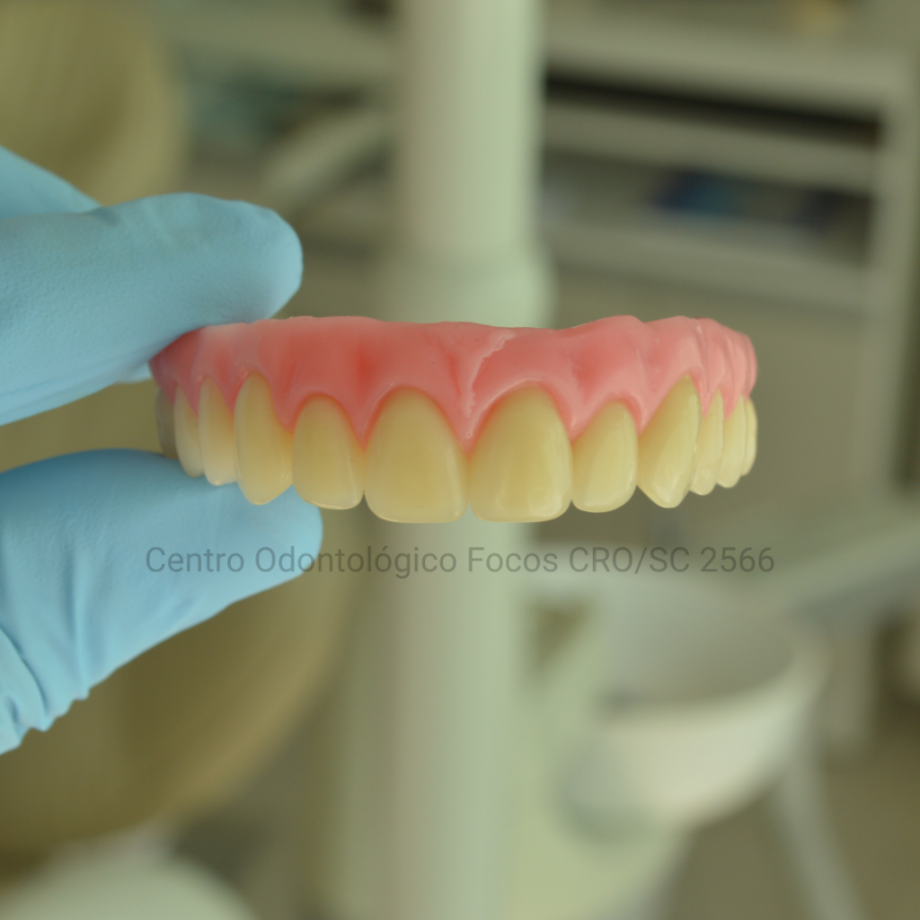 Clínica especializada em Prótese Protocolo em Florianópolis